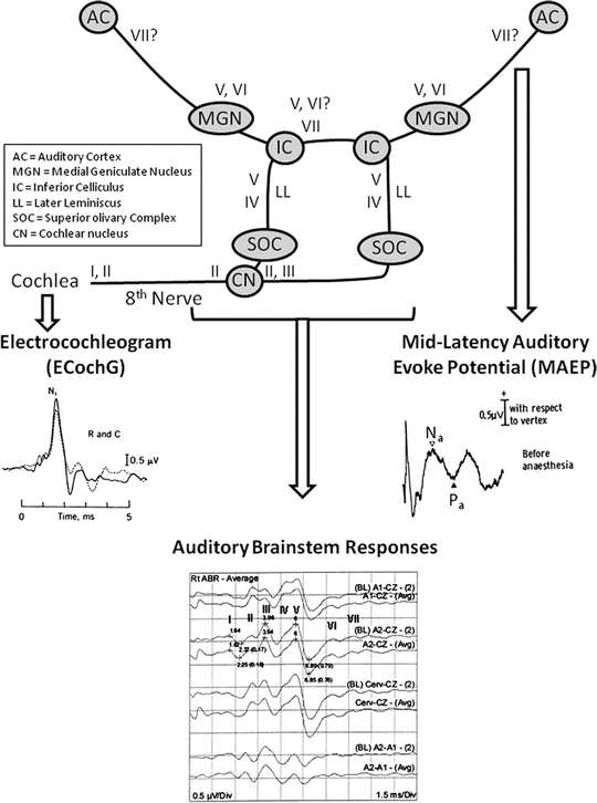 Auditory-Evoked Potentials | SpringerLink