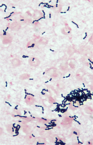 Enterococcal Infections in Adults | SpringerLink