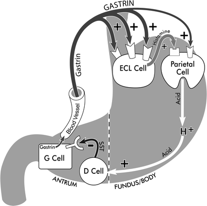 Helicobacter pylori-Induced Changes in Gastric Acid Secretion and Upper ...