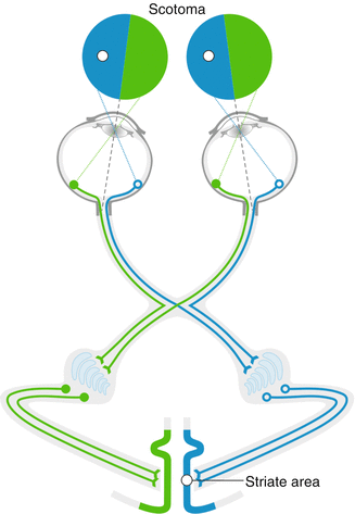 Anatomy of the Human Visual Pathway | SpringerLink