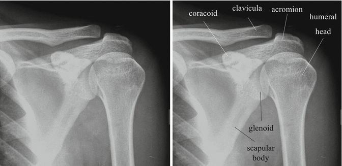 Shoulder Radiology | SpringerLink