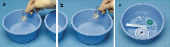 Transcatheter Aortic Valve Implantation: Abbott Portico | SpringerLink