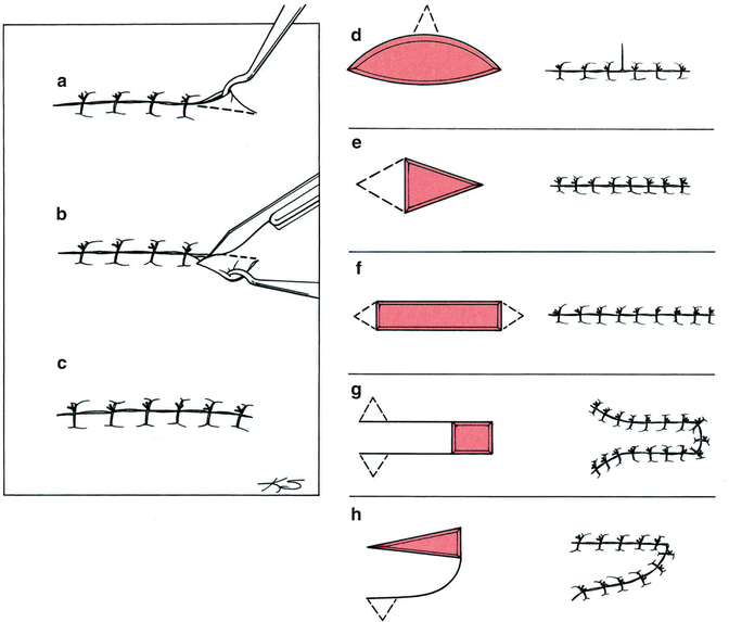 Basic Principles, Techniques, and Instruments | SpringerLink