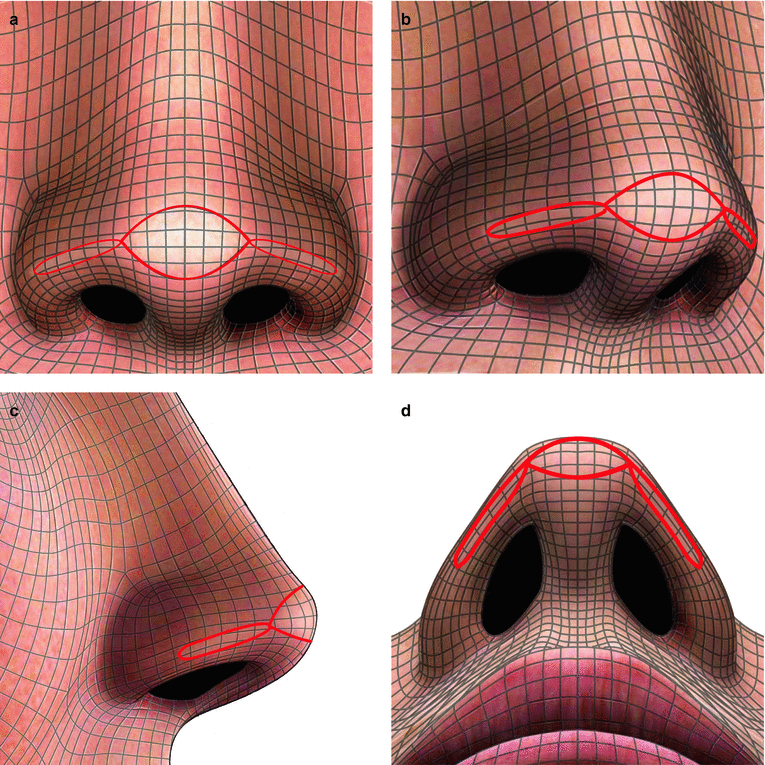 Surface Aesthetics and Soft Tissue Envelope | SpringerLink
