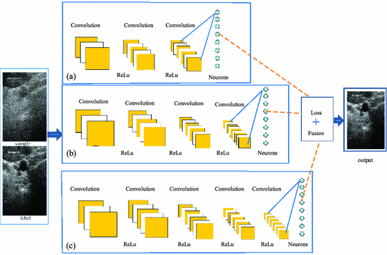 Super-Resolution Reconstruction of Plane-Wave Ultrasound Imaging Based ...
