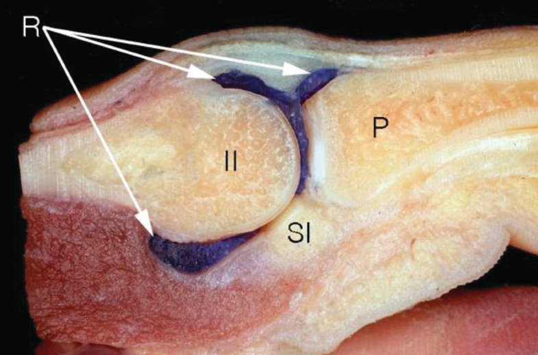 Gross Anatomy of the Human Hand | SpringerLink