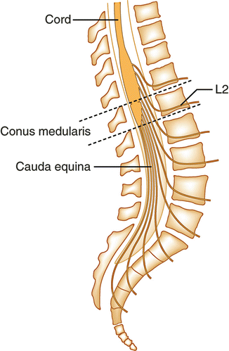 Neuraxial Blockade: Epidural Anesthesia | SpringerLink