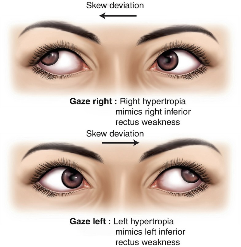 Neurologic Examination | SpringerLink