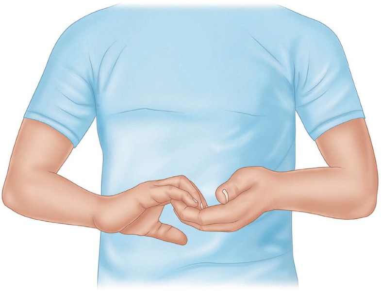 Neurologic Examination | SpringerLink