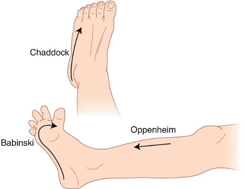 Neurologic Examination | SpringerLink