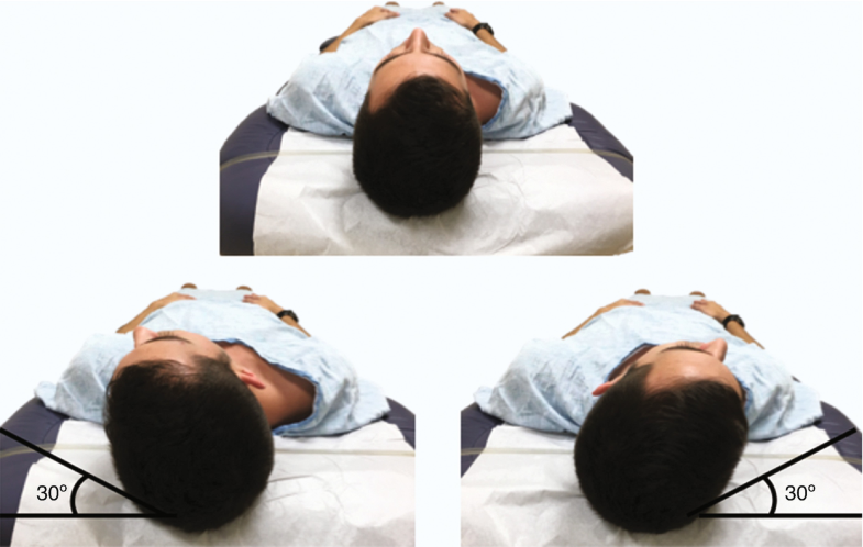 Pathophysiology and Diagnosis of BPPV | SpringerLink