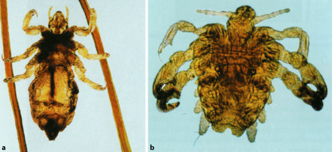 Ektoparasiten | SpringerLink
