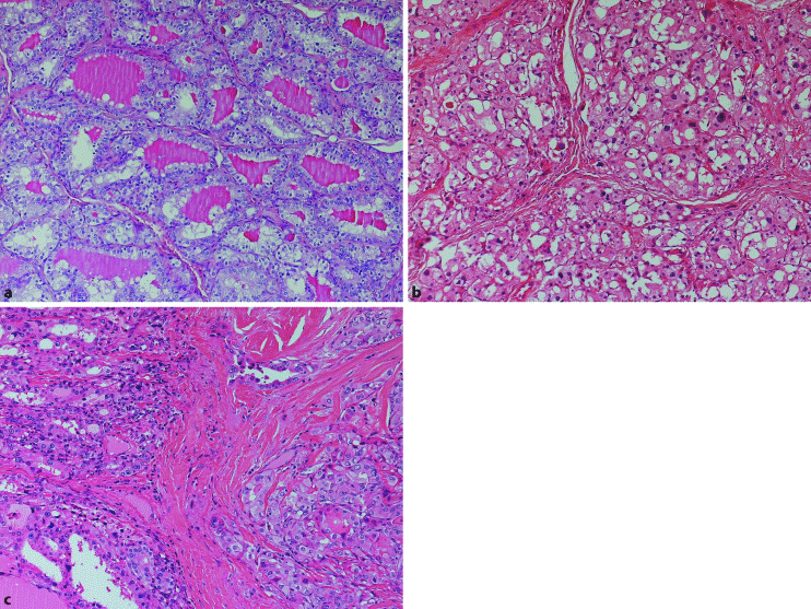 Schilddrüse | SpringerLink