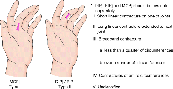 Diagnosis, Assessment, and Classification of Scar Contractures ...
