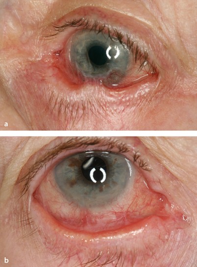 Bindehaut | SpringerLink