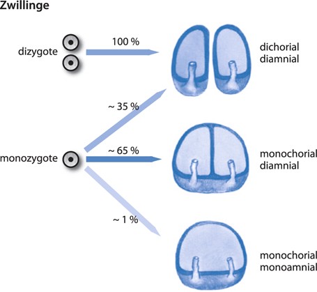 Mehrlinge | SpringerLink