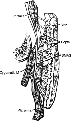 Anatomicohistologic Study of the Retaining Ligaments of the Face with ...