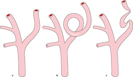 A. carotis interna | SpringerLink