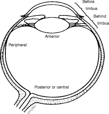 Special Techniques for Pars Plana Vitrectomy | SpringerLink