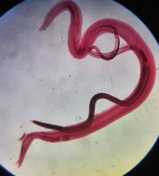 Schistosoma japonicum | SpringerLink