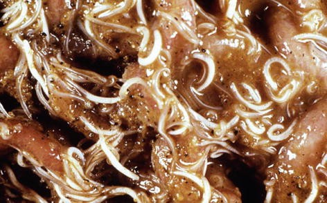 Trichuris | SpringerLink