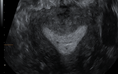 Uterus | SpringerLink