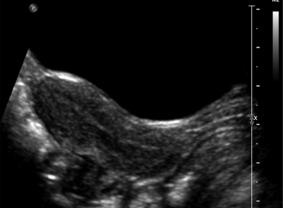 Uterus | SpringerLink