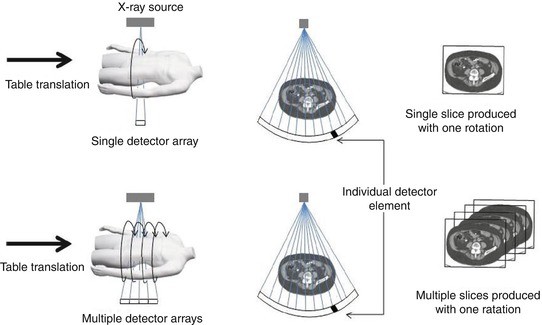 Physics and Technology of SPECT/CT | SpringerLink