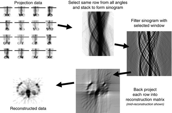Physics and Technology of SPECT/CT | SpringerLink