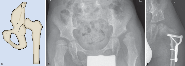 Spezielle Operationstechniken und Hinweise zur Nachbehandlung ...