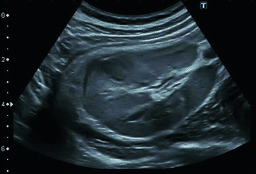 Niere, ableitende Harnwege und Harnblase | SpringerLink