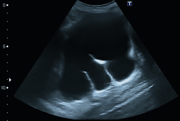 Niere, ableitende Harnwege und Harnblase | SpringerLink