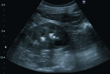 Niere, ableitende Harnwege und Harnblase | SpringerLink