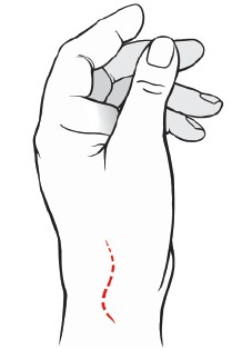 Hand und Handgelenk | SpringerLink