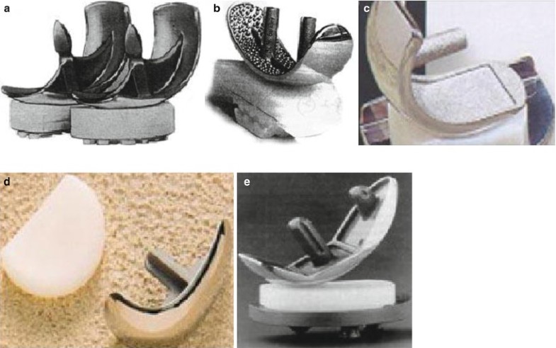 Unicompartmental Knee Arthroplasty | SpringerLink