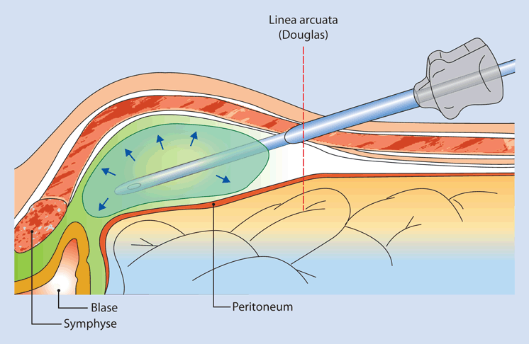 Urologie | SpringerLink