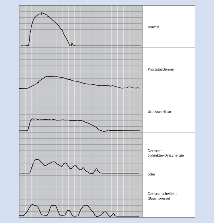 Grundlagen urodynamischer Untersuchungstechniken | SpringerLink