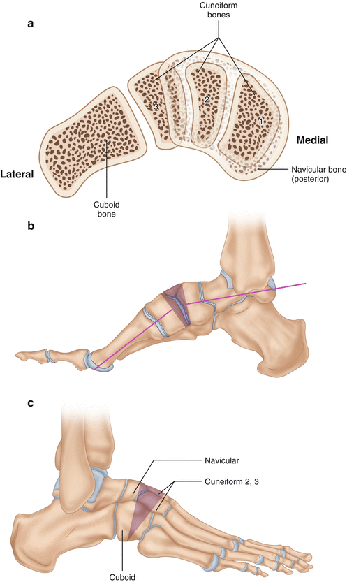 Cavus Foot | SpringerLink