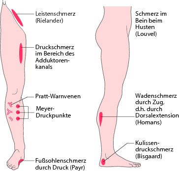 Pathophysiologische Grundlagen venöser Abflussstörungen | SpringerLink