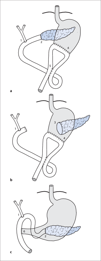The Pancreas | SpringerLink