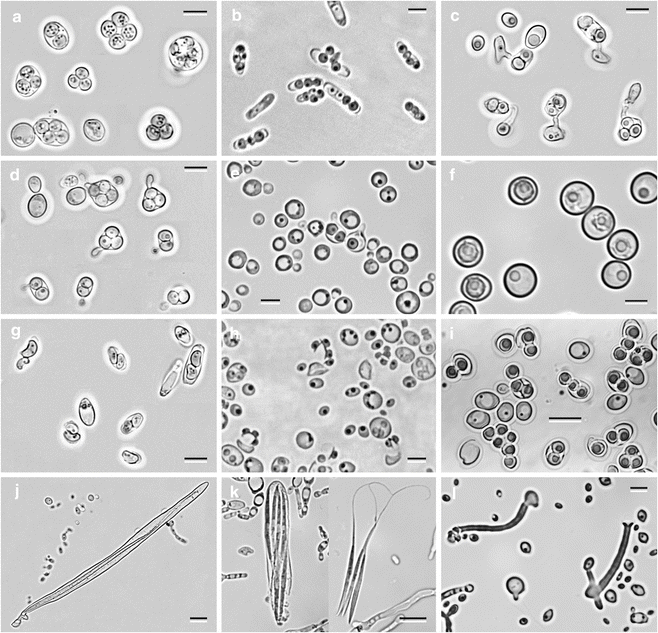 1 Saccharomycotina and Taphrinomycotina: The Yeasts and Yeastlike Fungi ...