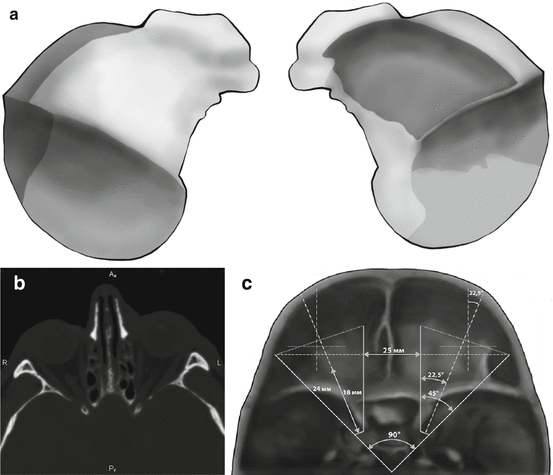 Clinical Anatomy of the Orbit and Periorbital Area | SpringerLink