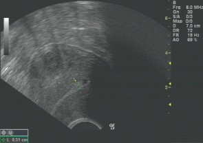 Uterus Springerlink