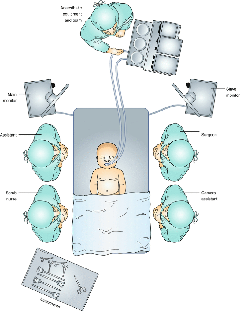 Laparoscopic Cholecystectomy | SpringerLink