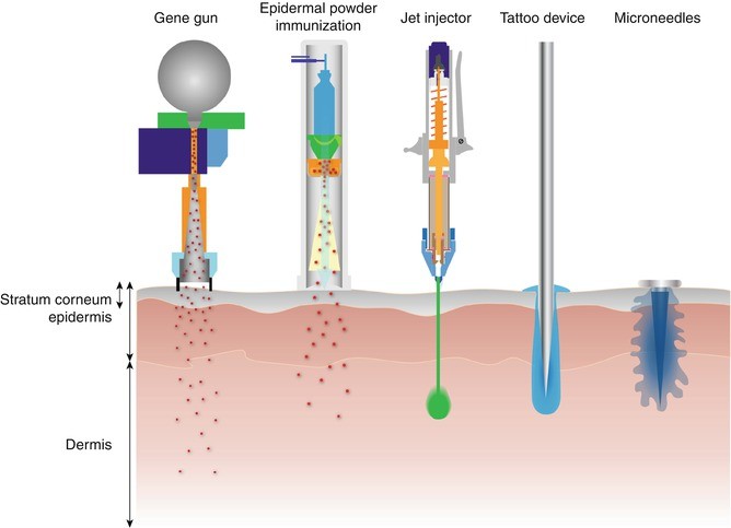 Skin Vaccination Methods: Gene Gun, Jet Injector, Tattoo Vaccine, and ...