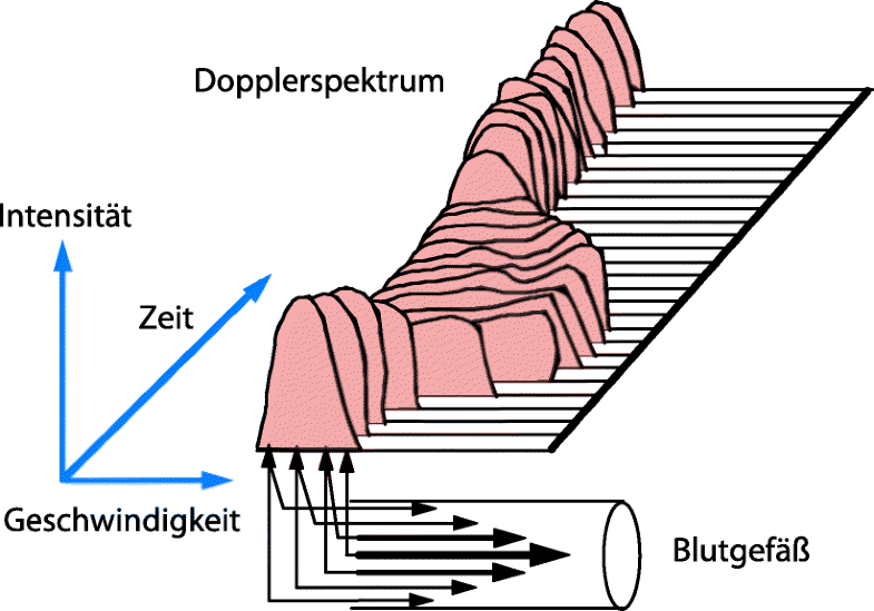 Physikalische und technische Grundlagen der Dopplersonographie ...