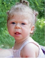 Angeborene Fehlbildungssyndrome | SpringerLink