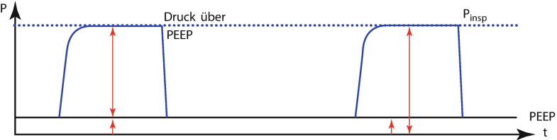 Druckkontrollierte Beatmung | SpringerLink