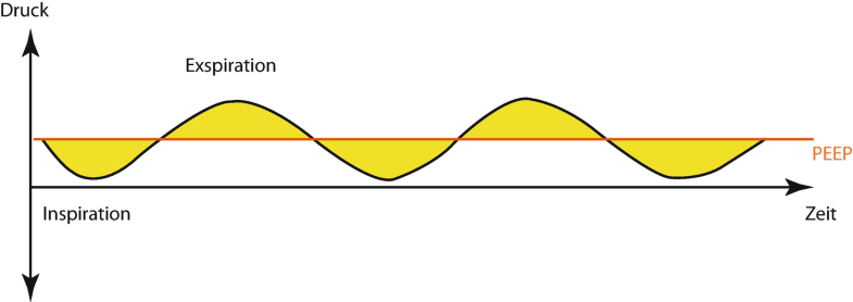 CPAP (Continuous Positive Airway Pressure) | SpringerLink