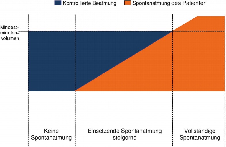 MMV (Mandatorische Minutenvolumen-Ventilation) | SpringerLink